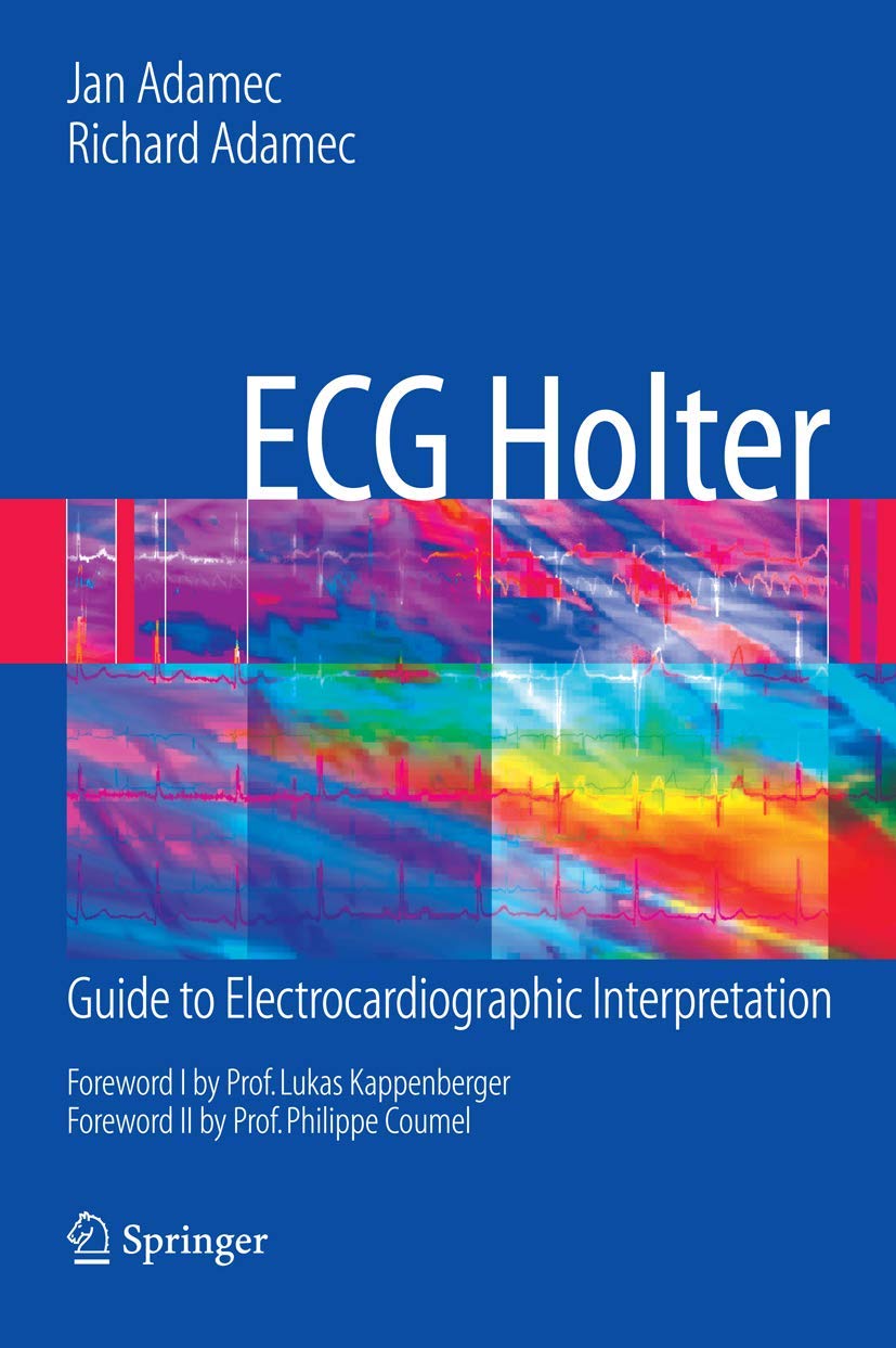 Amazon | ECG Holter: Guide to Electrocardiographic Interpretation ...