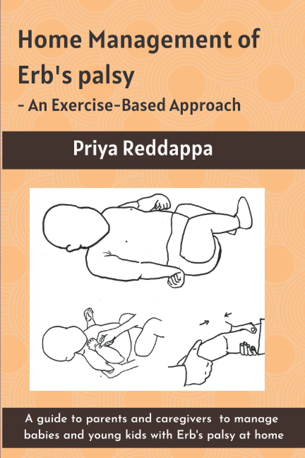 Home Management of Erb's Palsy - An Exercise-Based Approach: A guide to ...