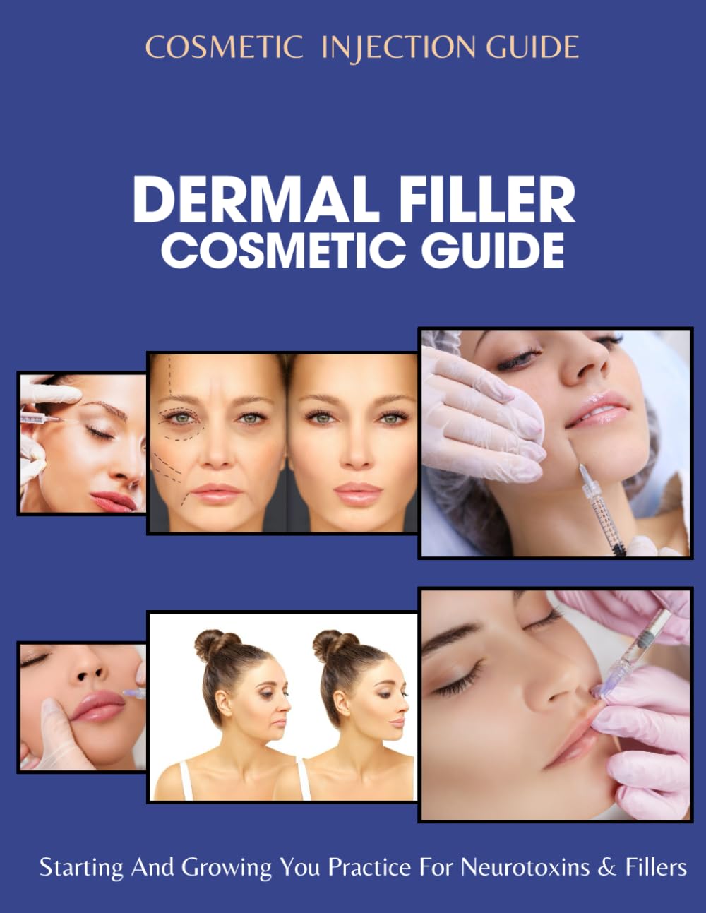 The Ultimate Dermal Filler Guide 2025 2026 A Beginners Guide ...