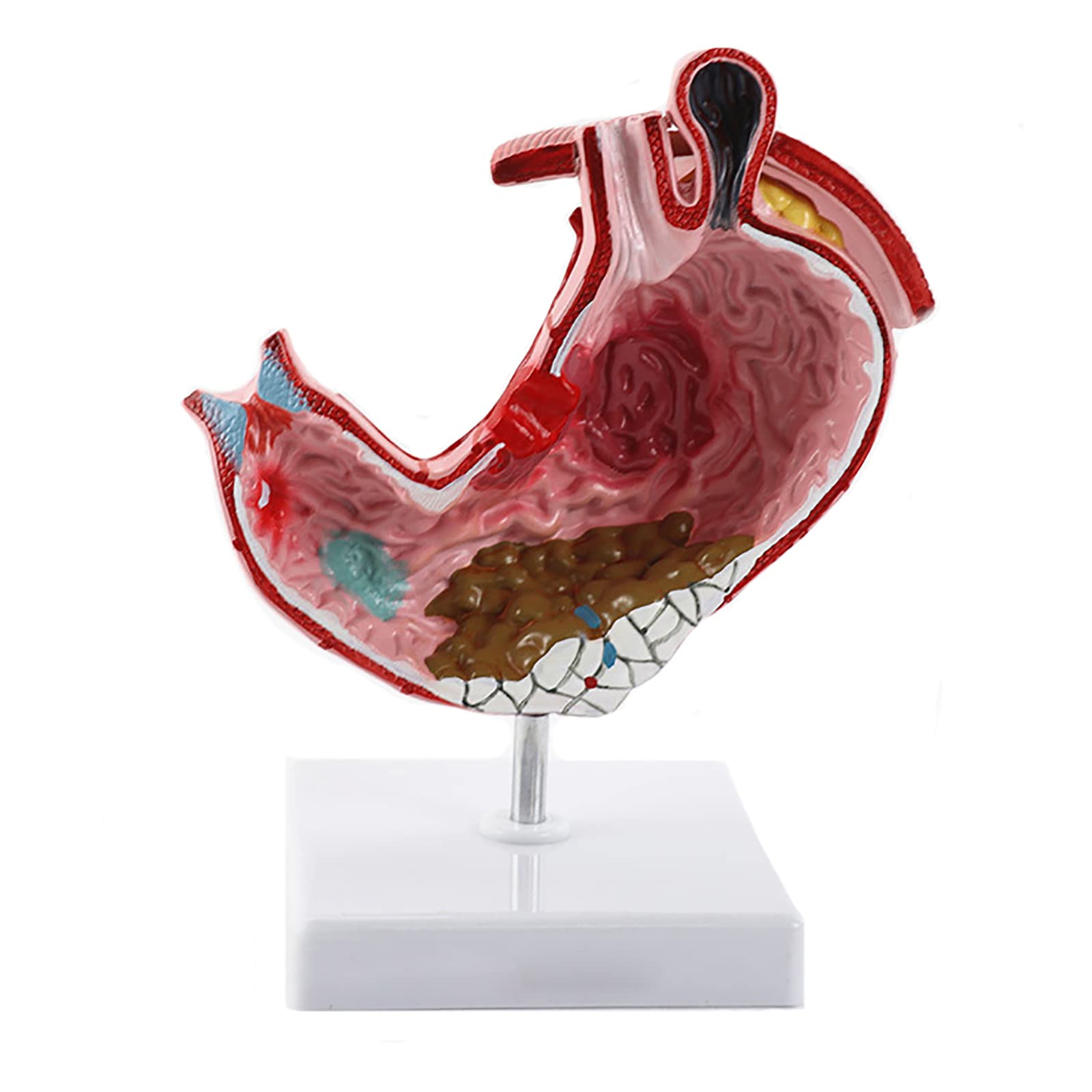 Buy Human Anatomical Stomach Model, tric Ulcer Anatomy Model,Medical ...