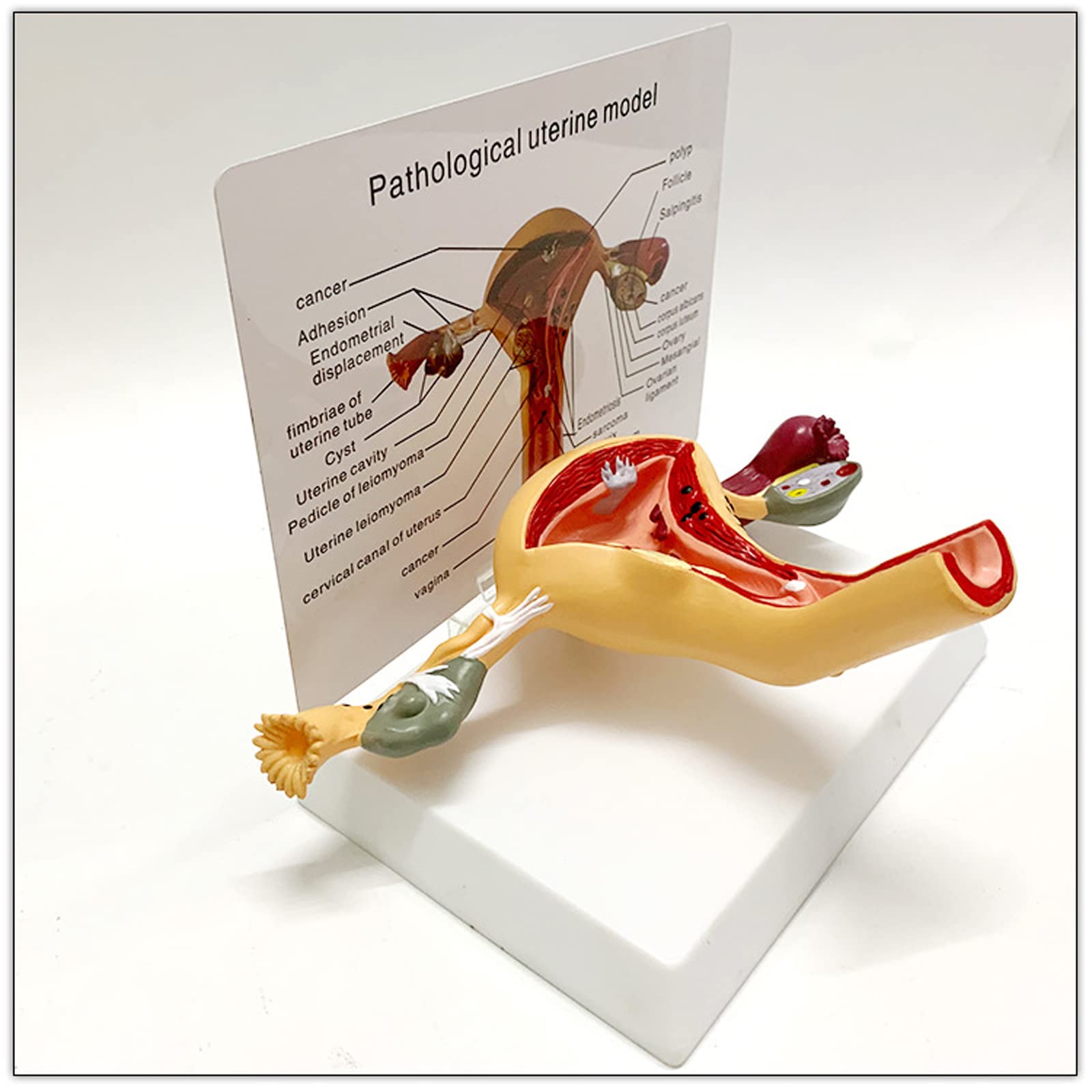 Uterine Cavity Model