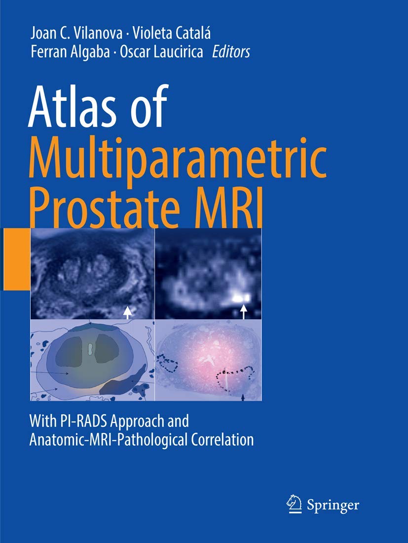 Buy Atlas of Multiparametric Prostate MRI: With PI-RADS Approach and ...