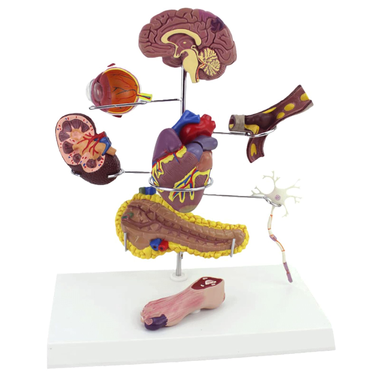 Froon Human Diabetic Organ Anatomy Model 8 Parts Organ Model ...