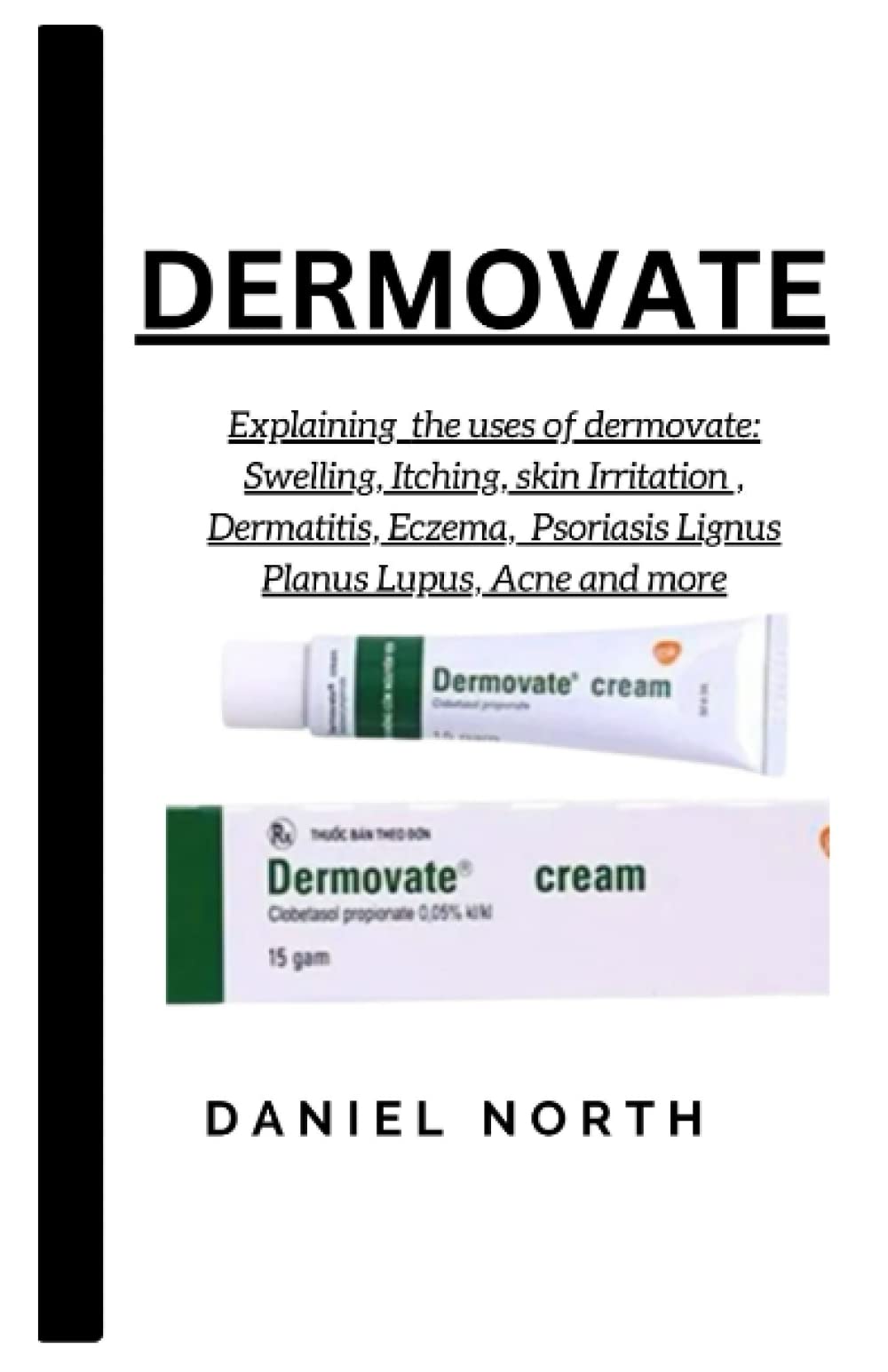 Buy DERMOVATE: Explaining The Uses Of Dermovate: Swelling, , Skin ...
