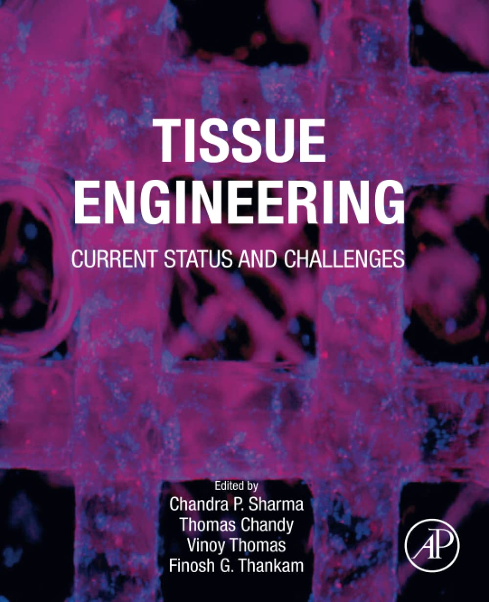 Amazon.com: Tissue Engineering: Current Status and Challenges ...
