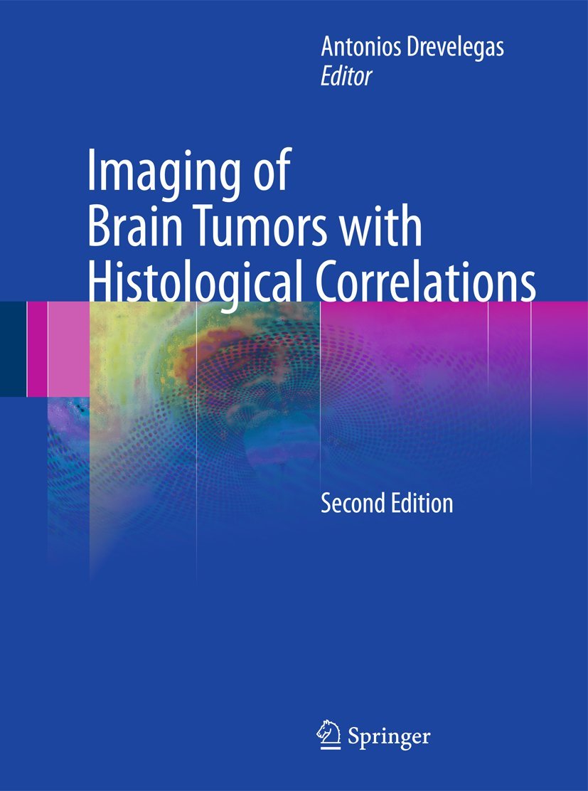 Imaging of Brain Tumors with Histological Correlations: 9783540876489 ...