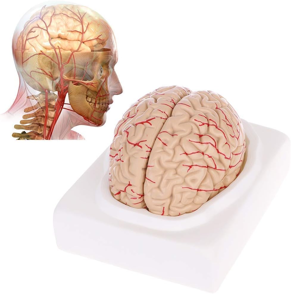 Amazon.com: Human Brain Model - Disassembled 8 Parts Cerebrovascular ...