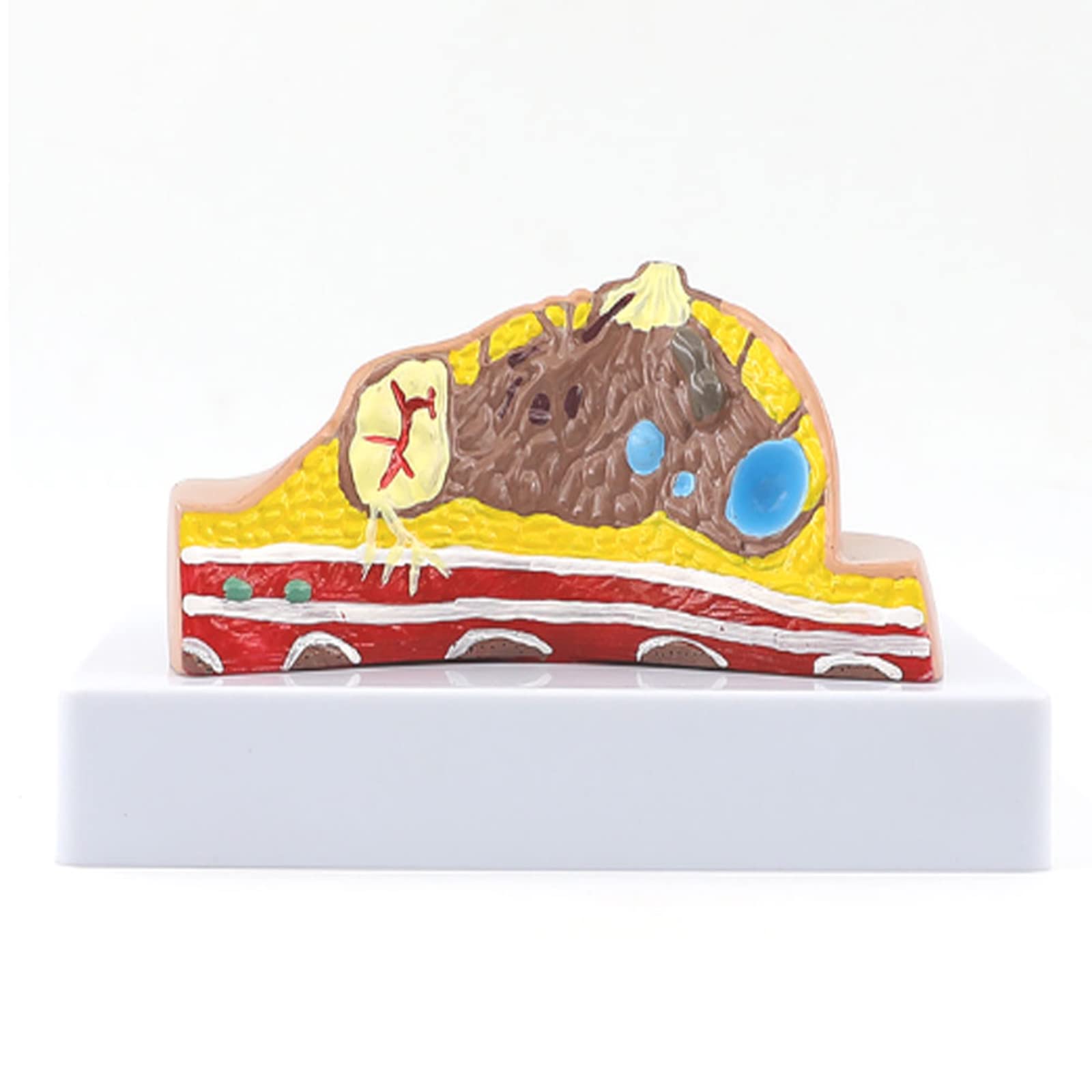 Wsxka Female Breast Anatomy Model Breast Cross Section Model Human ...