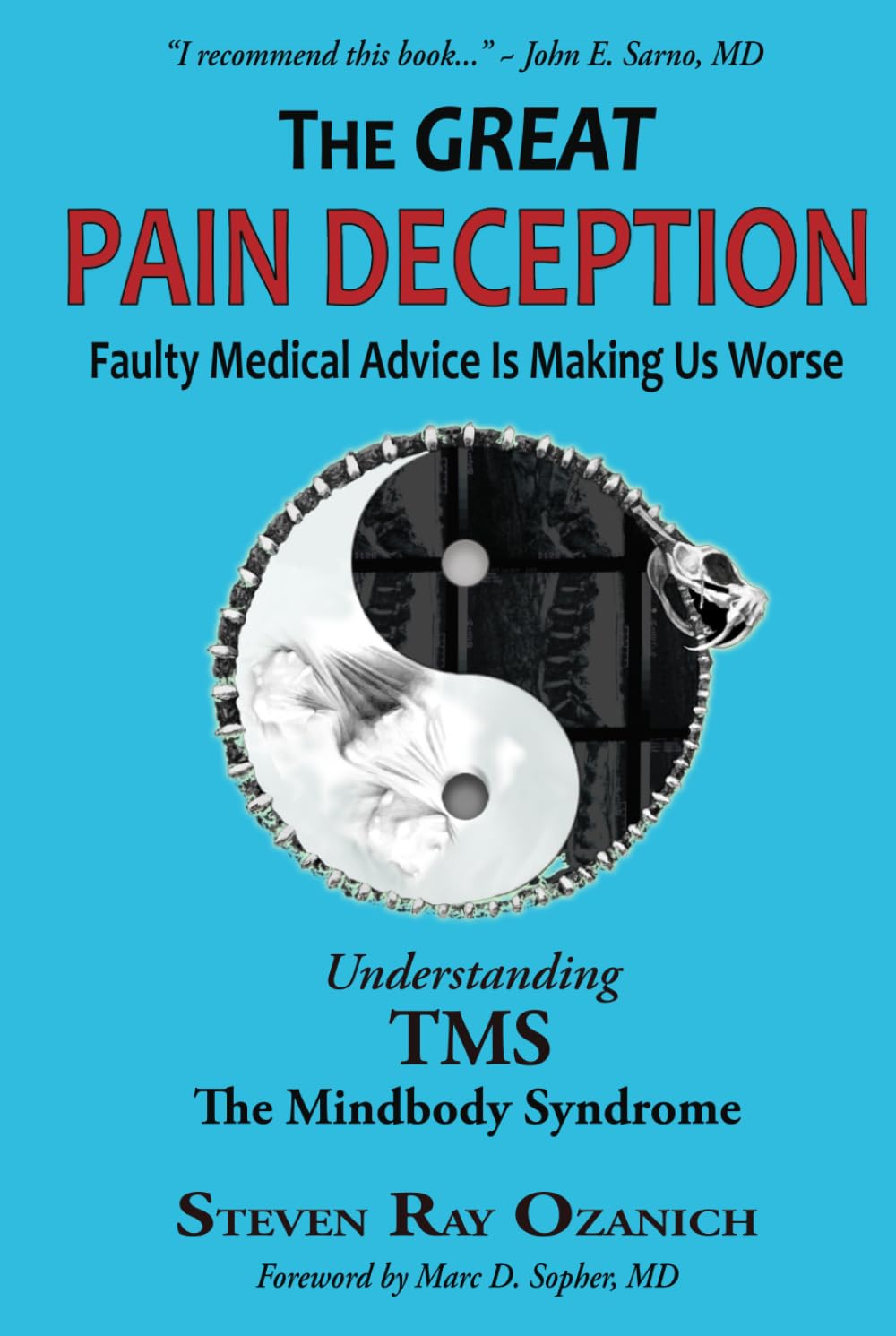 The Great Pain Deception: Faulty Medical Advice Is Making Us Worse ...