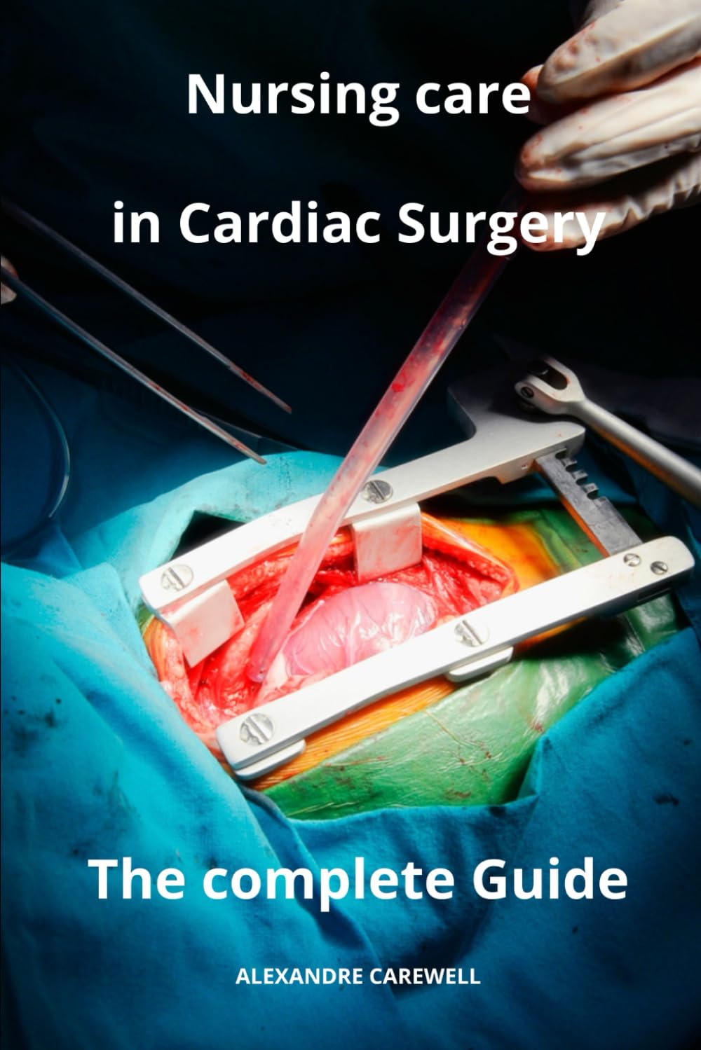 Nursing Care in Cardiac Surgery The complete Guide: CAREWELL, ALEXANDRE ...