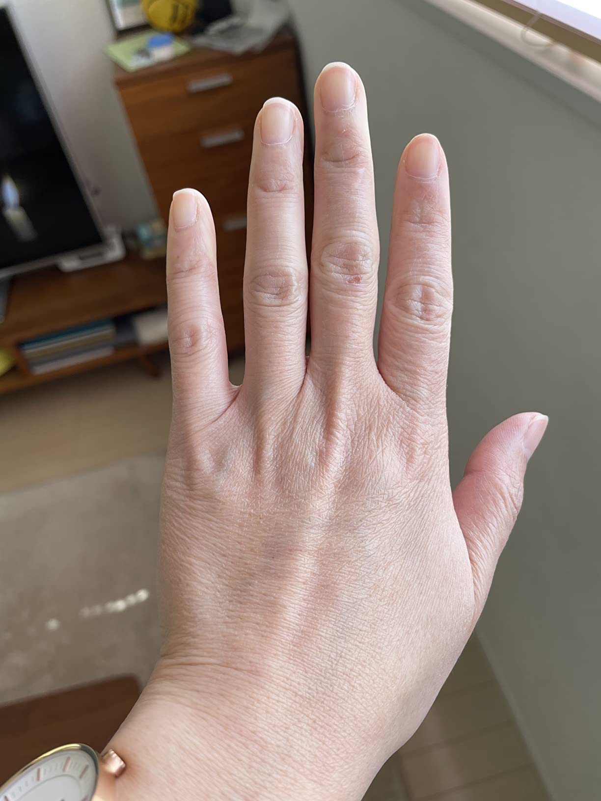 Amazon.co.jp: EORA プラス ハンドパック ゼラニウム 10枚セット（指先カット施術タイプ） : ビューティー