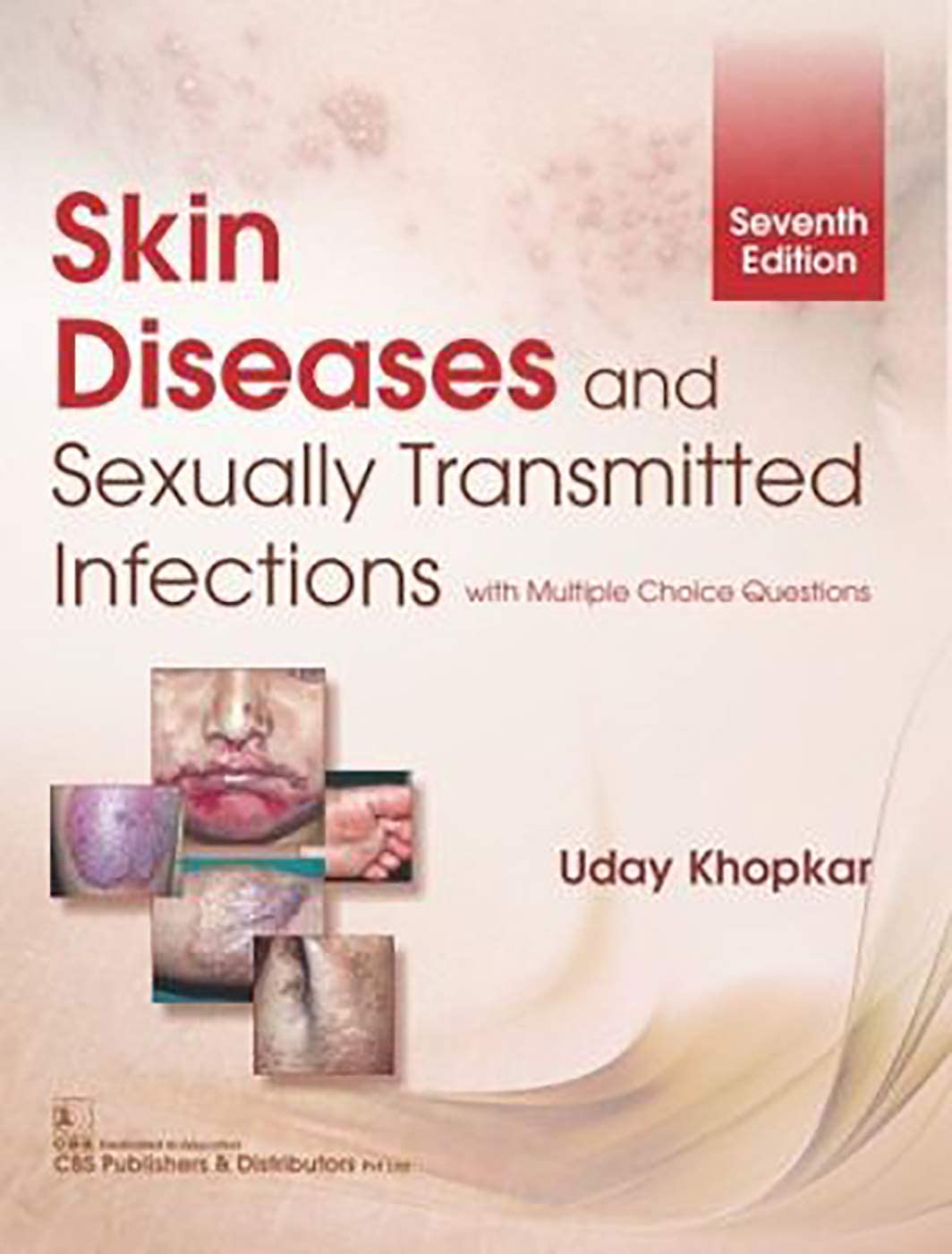 Buy SKIN DISEASES AND SEXUALLY TRANSMITTED INFECTIONS 7ED (PB 2023 ...