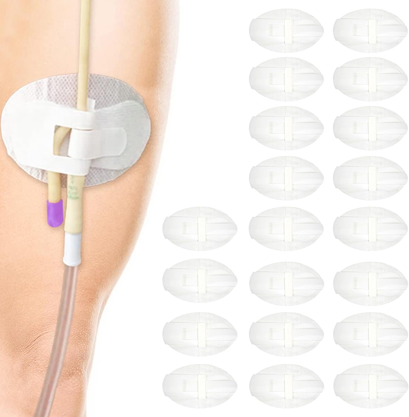 Amazon.com: COTOPGY Catheter Stabilization Device, 15Pcs Catheter ...