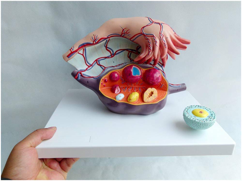 Zvcv Ovarian Uterus Model Human Organ Anatomy Model Ovarian ...