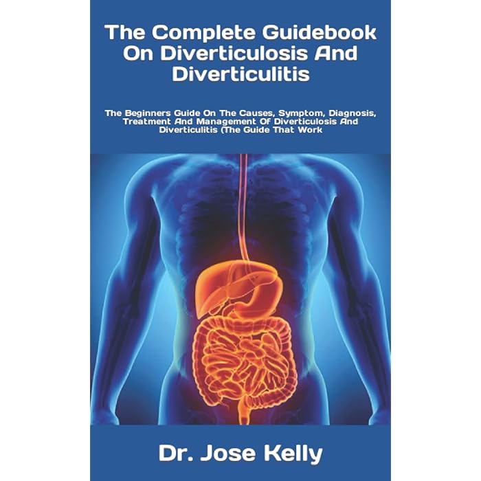 Buy The Complete Guidebook On Diverticulosis And Diverticulitis: The ...