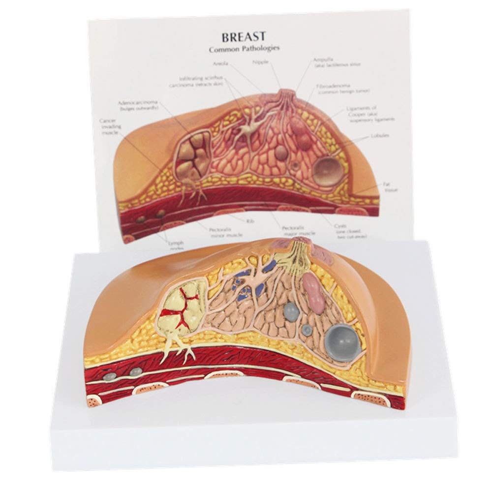 Buy YUANZHOU Lesion Model, Medical Anatomical Model, Medical Training ...