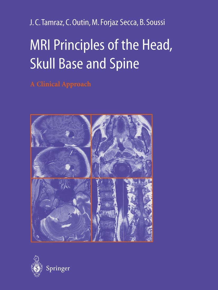 Buy MRI Principles of the Head, Skull Base and Spine: A Clinical ...