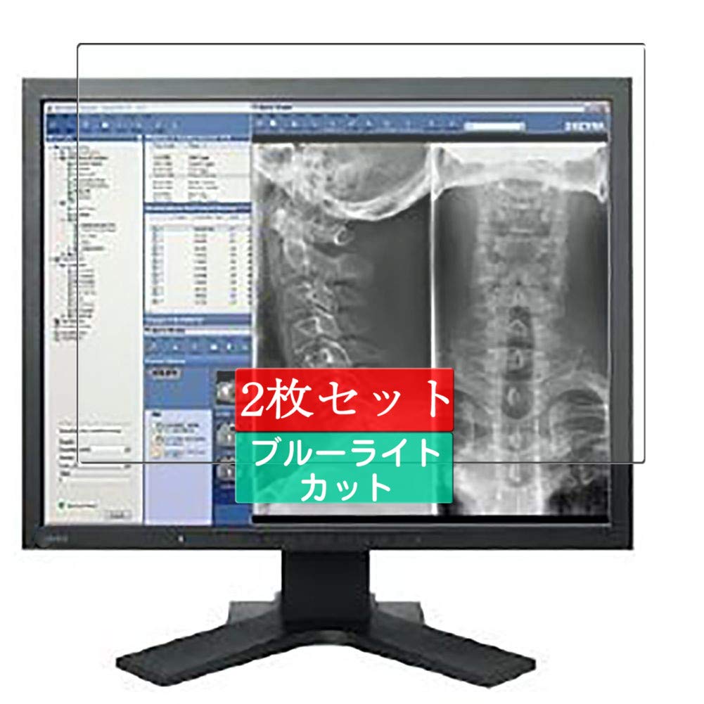 Amazon | 2枚 Sukix ブルーライトカット フィルム 、 Eizo Flexscan Mx210 21インチ ディスプレイ ...