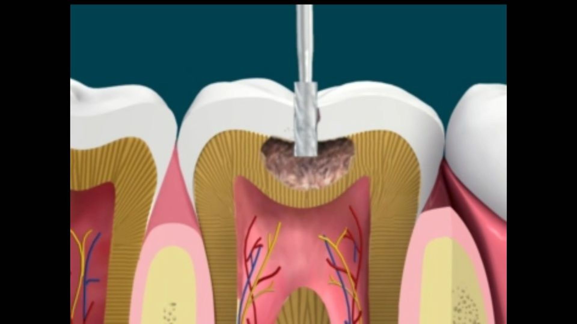 The Tooth Dental Consultation software - App on the Amazon Appstore