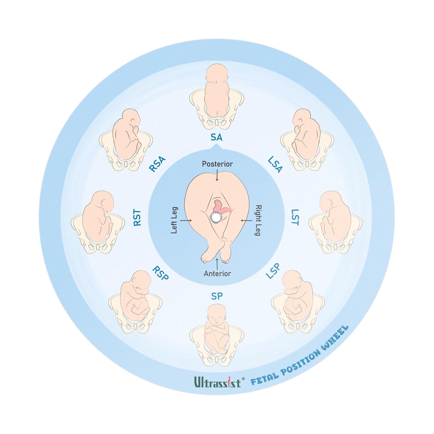 Amazon.com: Ultrassist Midwife Fetal Position Tool - Small Size 5.12 ...