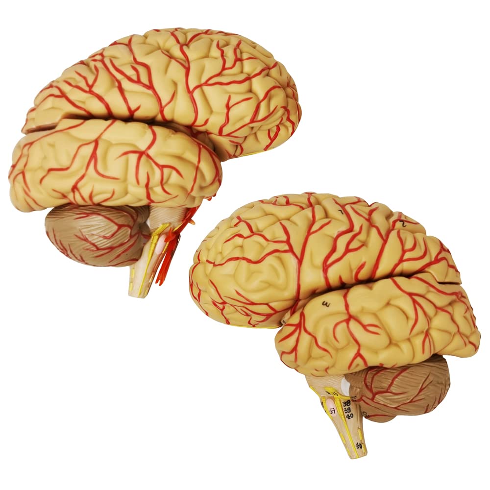 Snapklik.com : Evotech Human Brain Model w/Arteries, 9 Parts Life Size ...