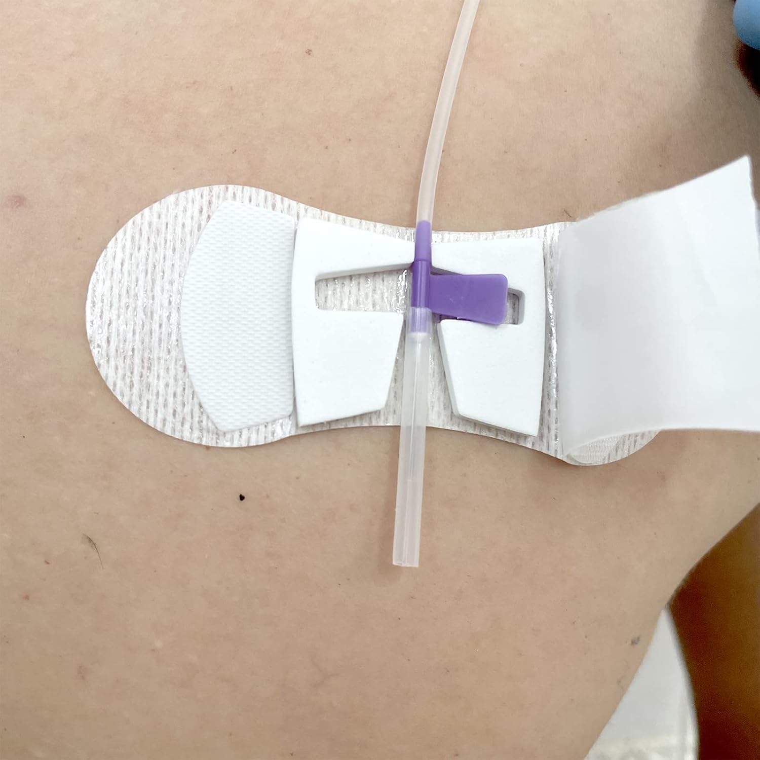 Cateter Linha Picc Cateter PowerPICC™ SV BD