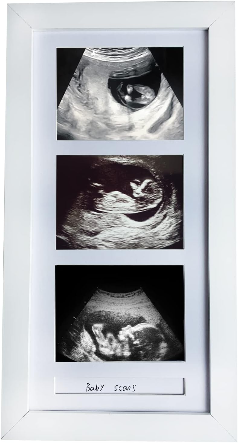 Amazon.com: trlry Triple Ultrasound Picture Frames, Sonogram Picture ...