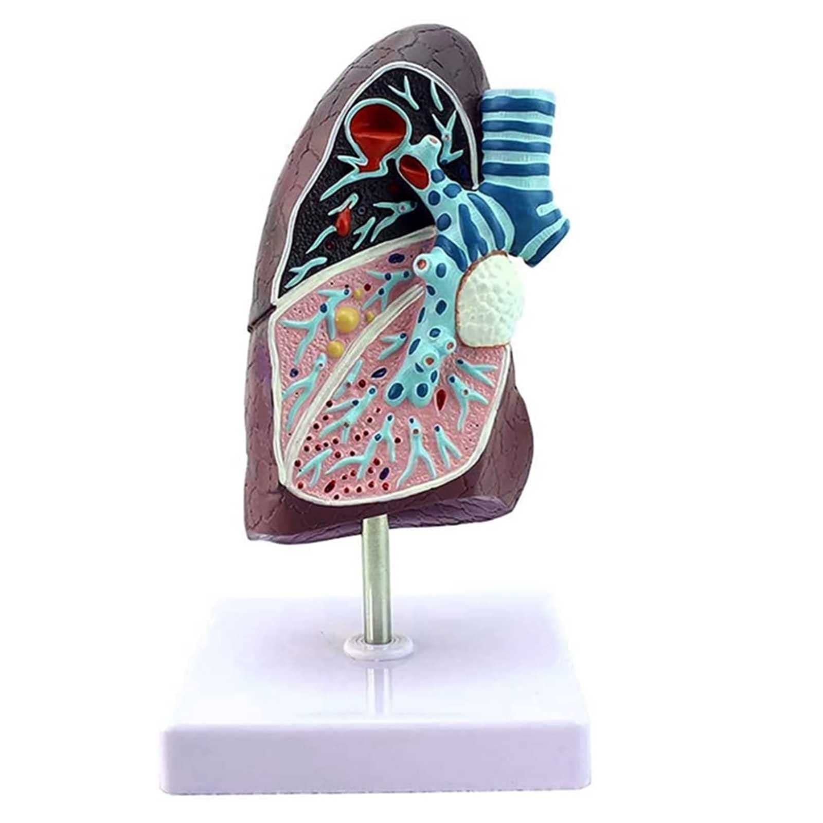 Buy Kedelack Human Lung Model, Human Anatomical Lung Pathology Anatomy ...
