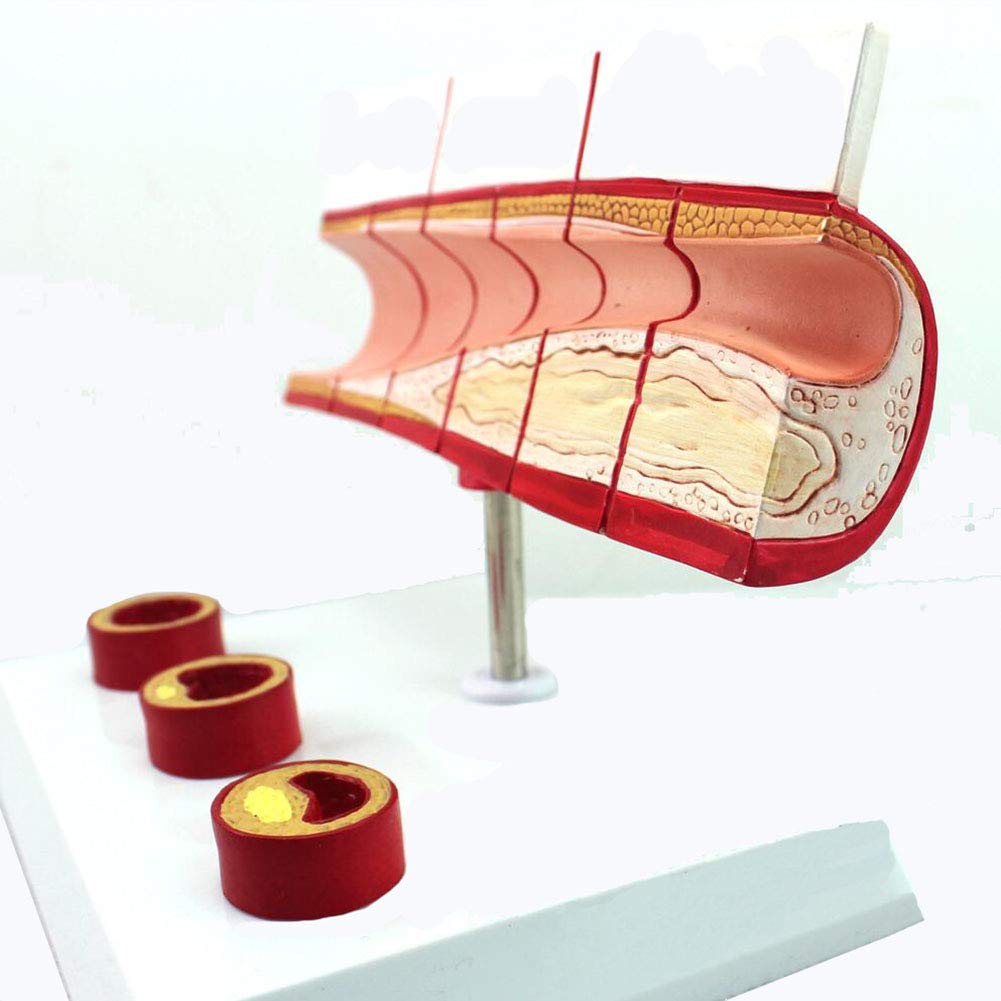Buy WHYTT Blood Cholesterol and Age Model Human Skeleton Model This ...