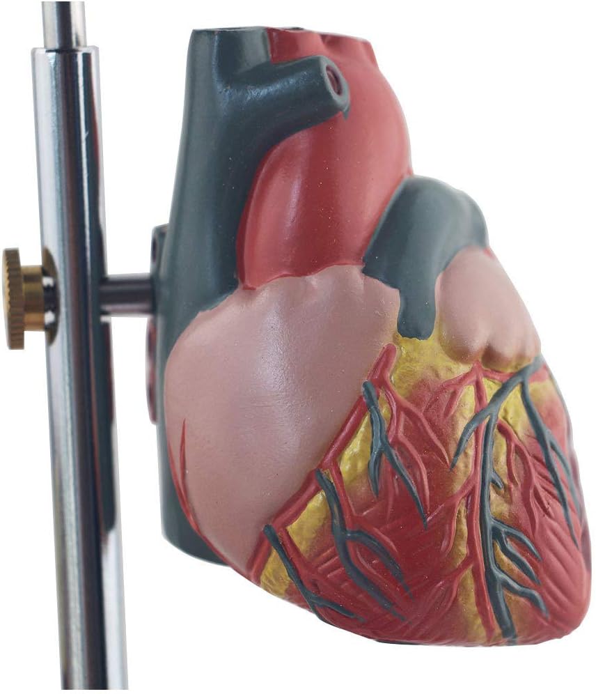 Amazon.com: KH66ZKY Human Hypertension Organ Anatomical Model - Brain ...