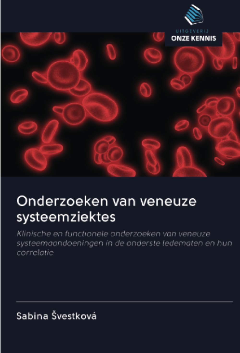 Buy Onderzoeken van veneuze systeemziektes: Klinische en functionele ...