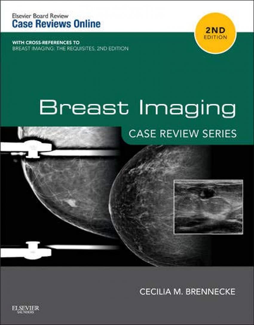 Breast Imaging: Case Review Series: 9780323087223: Medicine & Health ...