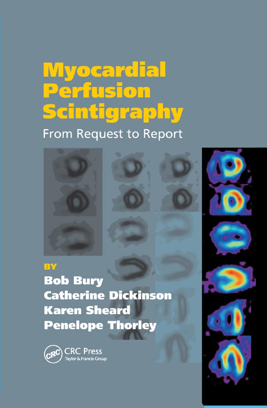 Myocardial Perfusion Scintigraphy: From Request to Report: Bury, Bob ...