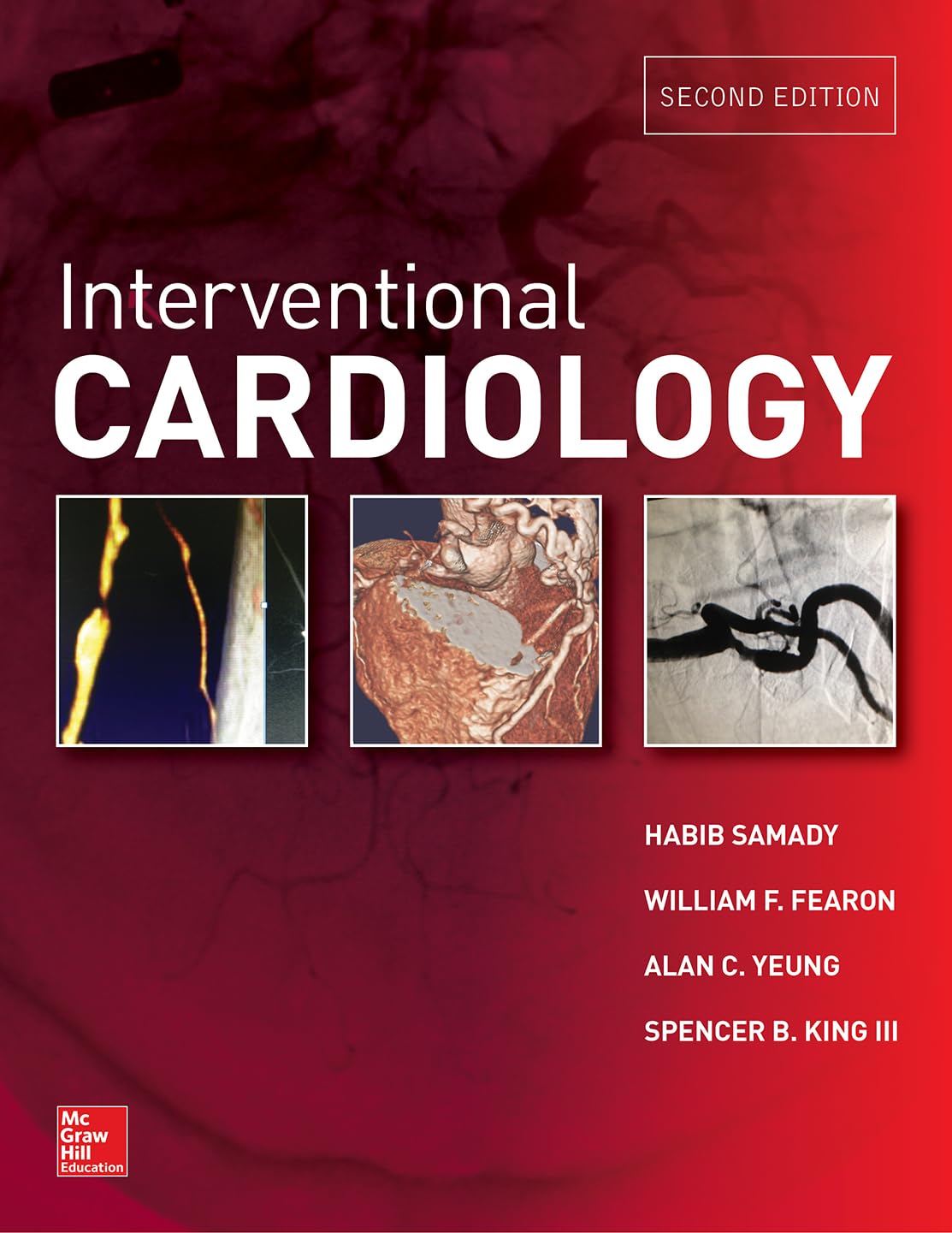 Interventional Cardiology, Second Edition: Samady, Habib, Fearon ...