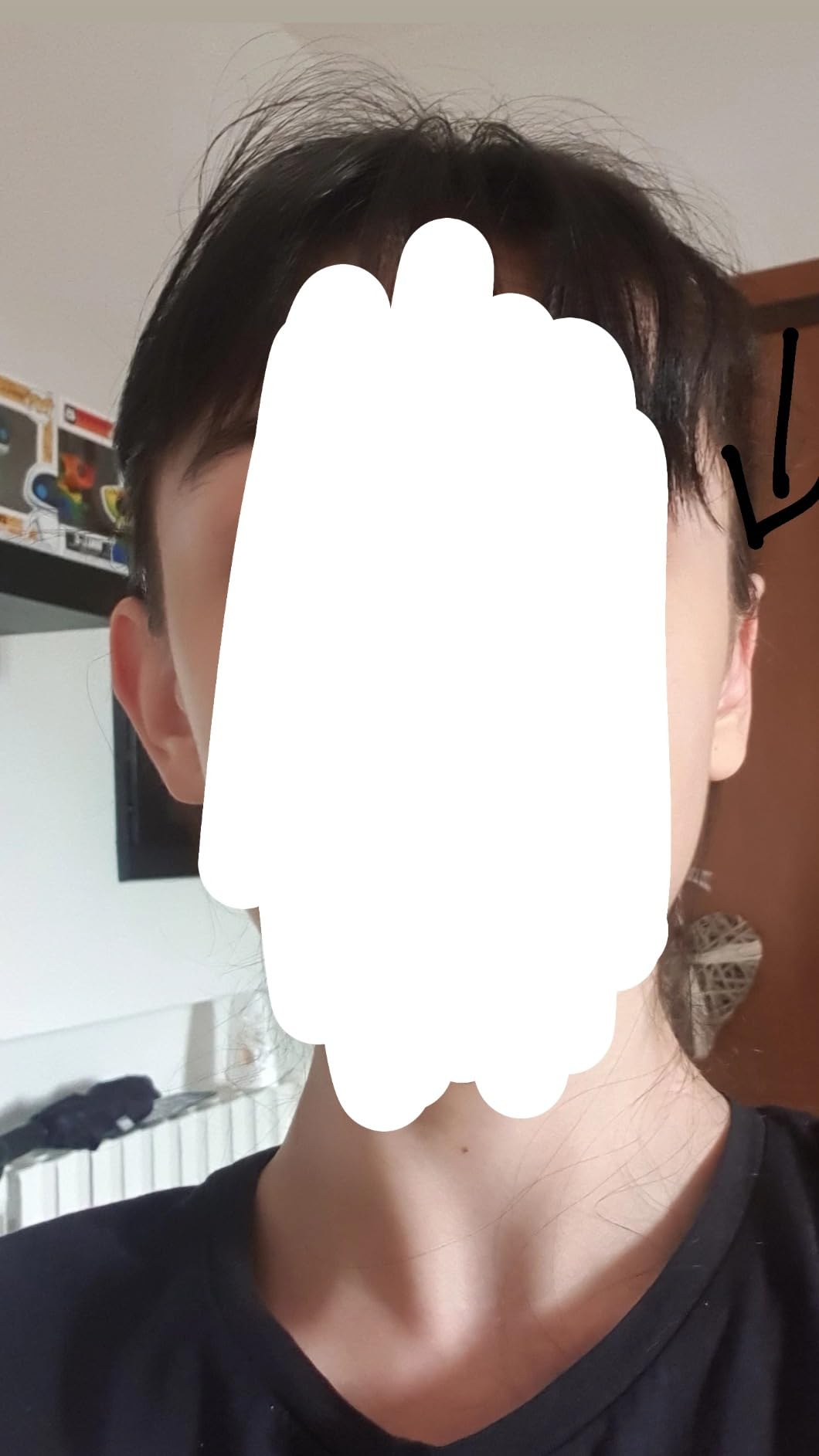 Otostick | Correttore per Orecchie a Sventola | Contiene 8 correttori ...