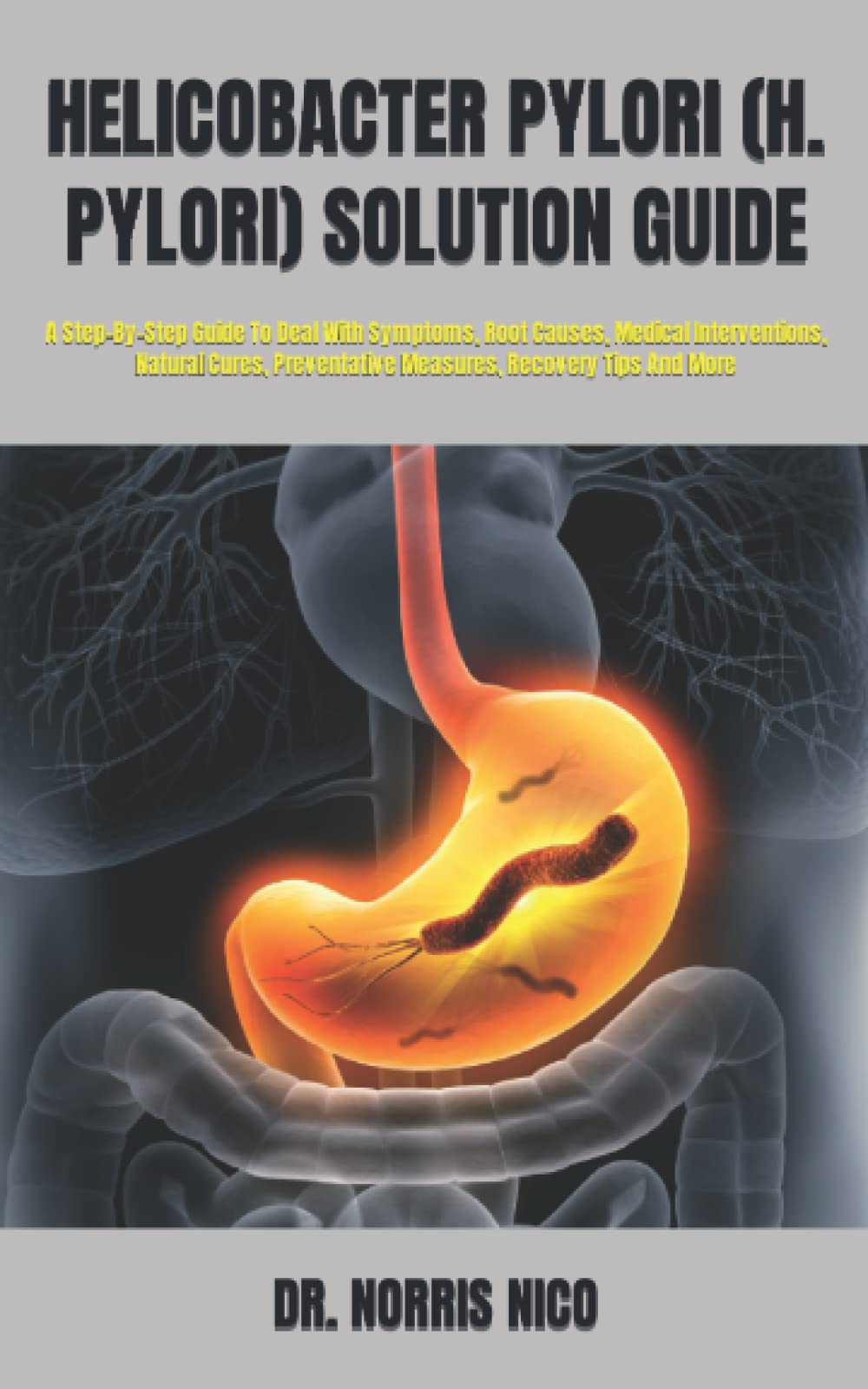 Helicobacter Pylori H Pylori Solution Guide A Step By Step | Desertcart ...