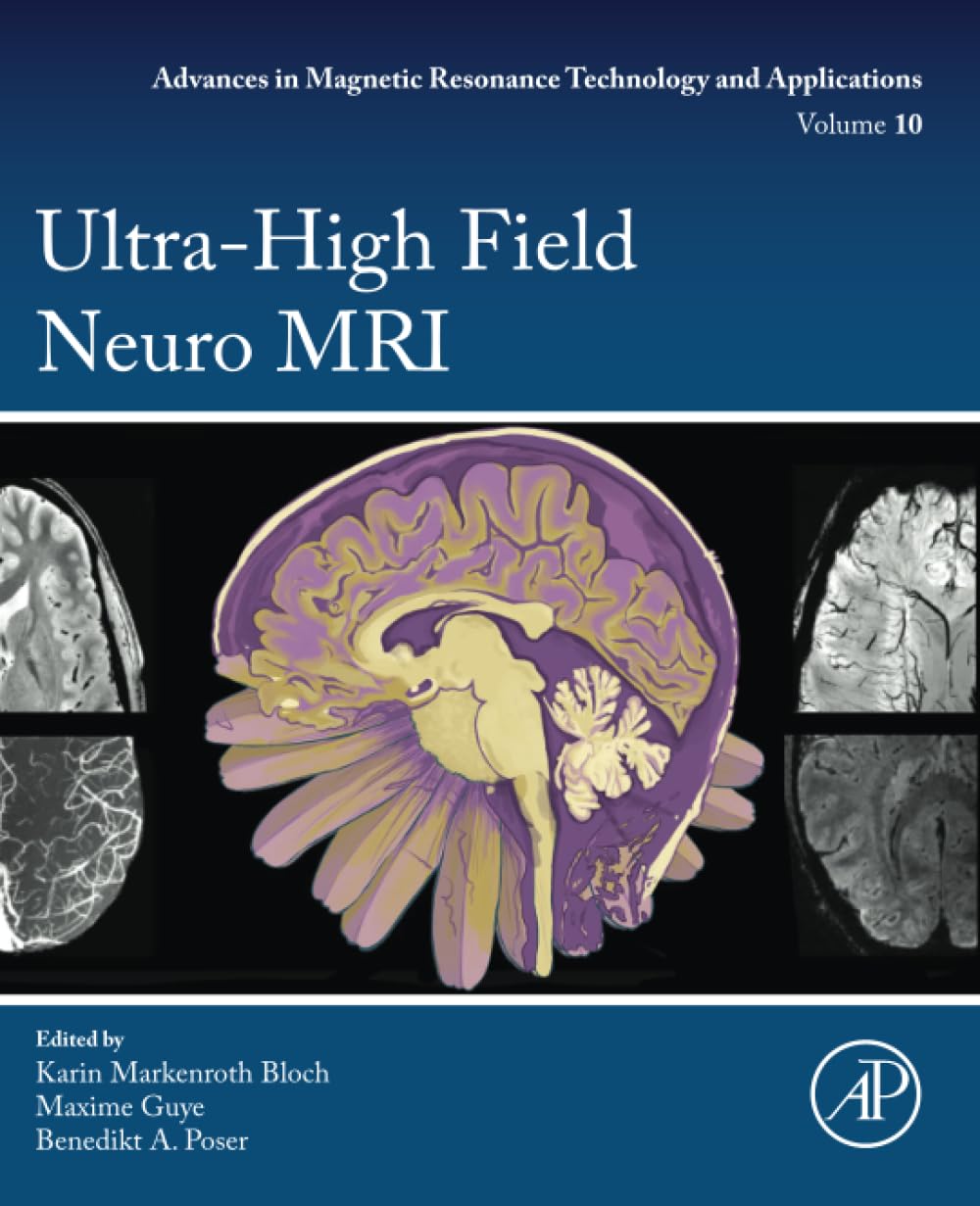 Ultra-High Field Neuro MRI... by Markenroth Bloch, Karin
