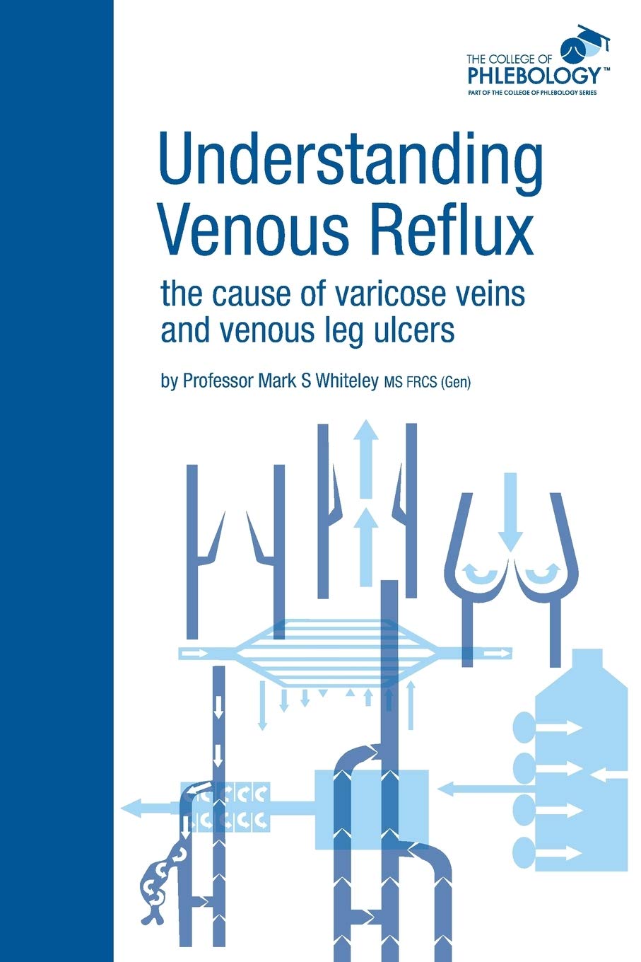 Understanding Venous Reflux The Cause Of Varicose Veins And Venous ...