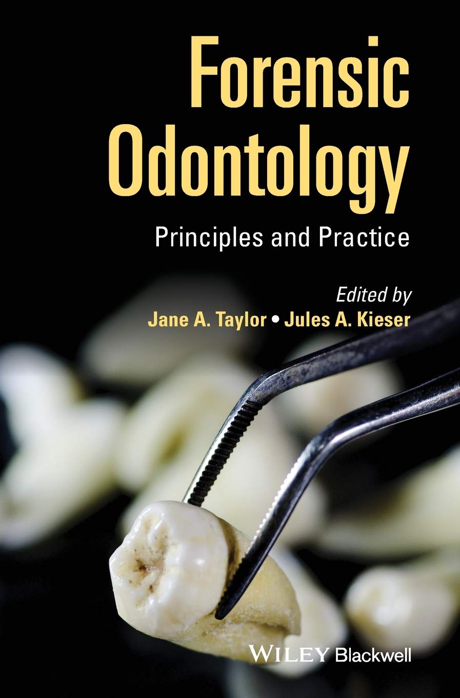 Forensic Odontology: Principles and Practice: 9781118864449: Medicine ...