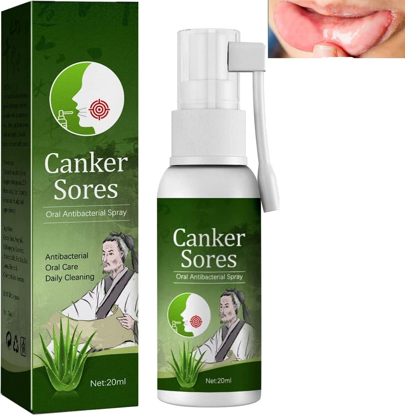 Buy Ulcer Breath Sprays,Canker Spray,Antiviral Mouth Spray,Treat Mouth ...