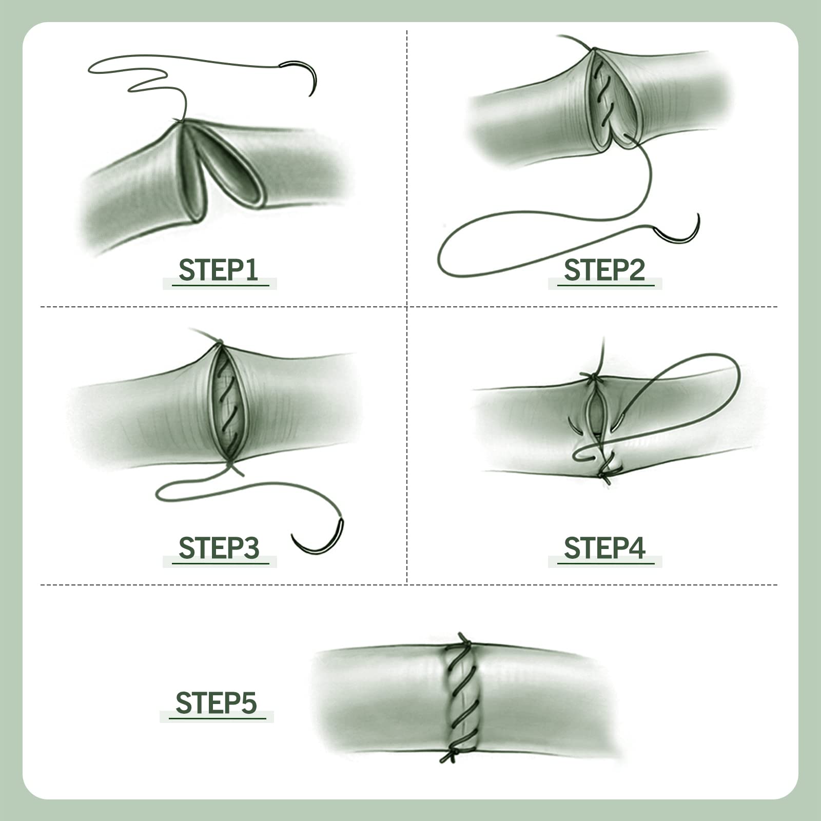 Snapklik.com : Medarchitect Intestine Suture Model