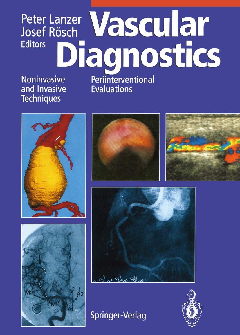 Vascular Diagnostics: Noninvasive and Invasive Techniques ...
