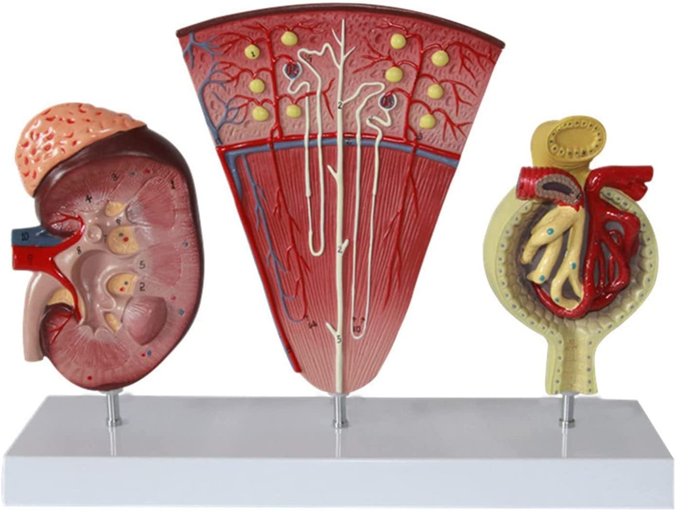 Buy ANATOMIC MODEL OF HUMAN KIDNEY 3 EXTENDED MODELS OF THE ANATOMIC ...