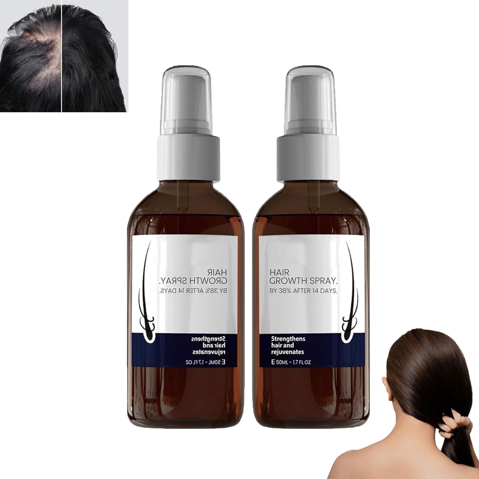Amazon.com : YG LianKai 2Pcs Hair Growth Spray, Oil for Men & Women By ...