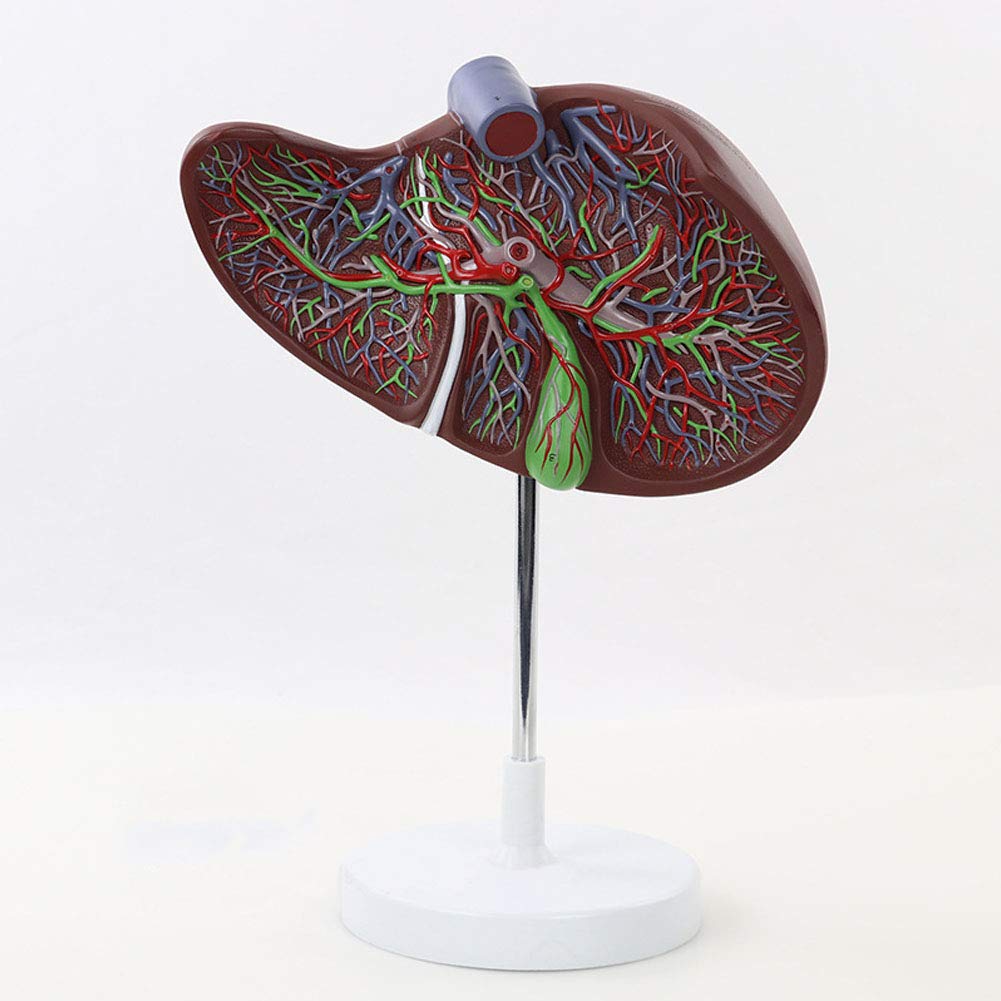 Liver Anatomical Model Shows The Lobes Of The Liver The Vascular ...
