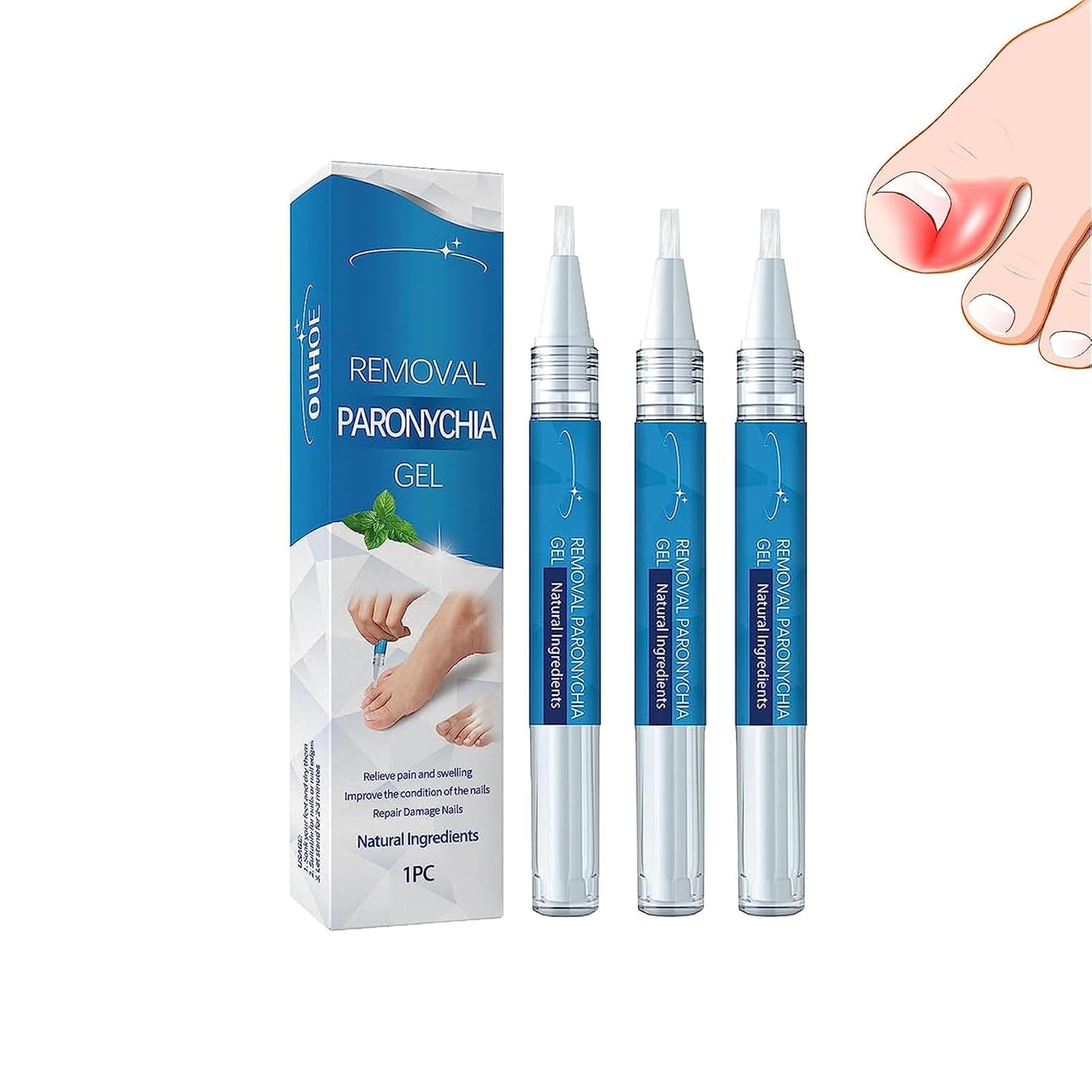 Toenailcare Removal Paronychia Gel, Nail Repair Pen, Nail Treatment Pen ...