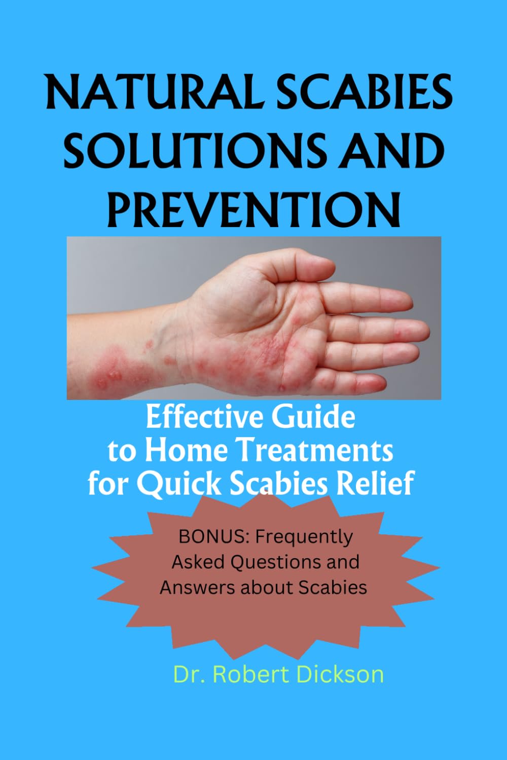 Scabies Prevention