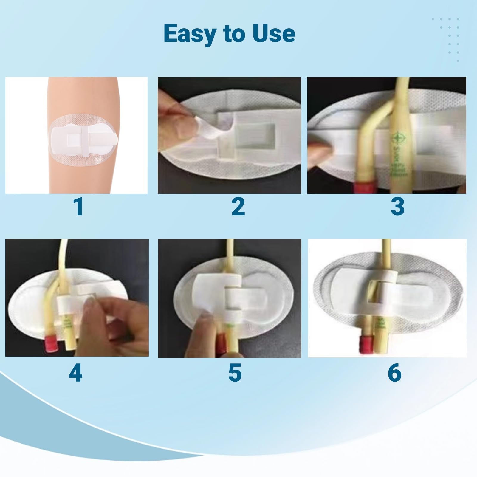 Snapklik.com : 20 PCS Catheter Stabilization Devices, Catheter Stickers ...