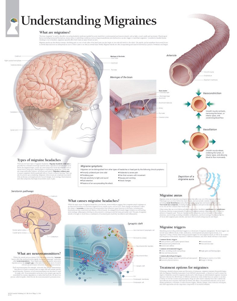 Snapklik.com : Understanding Migraines Chart: Wall Chart
