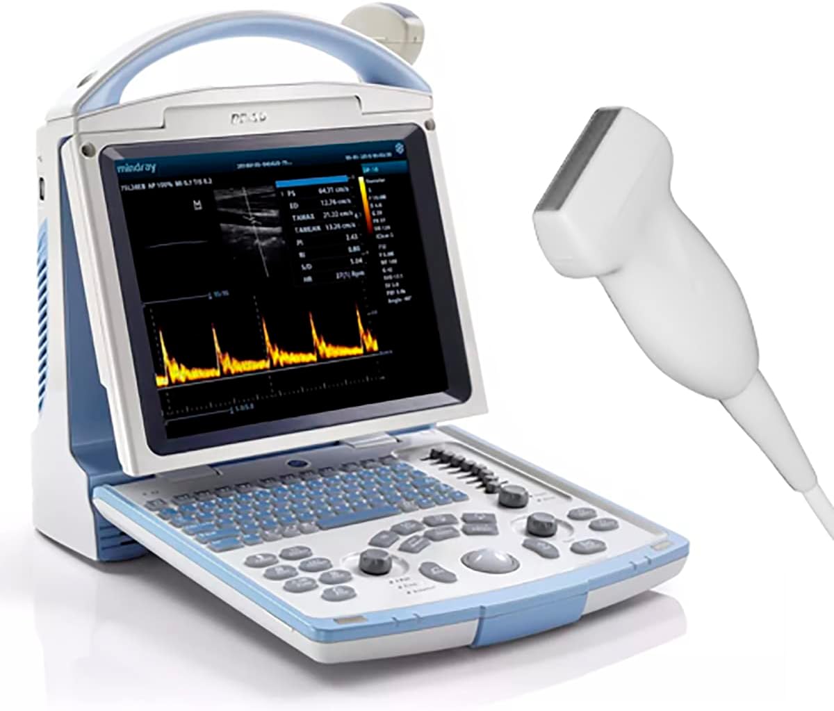 Ultrasonido Portatil uso humano con 1 transductor Lineal : Amazon.com ...